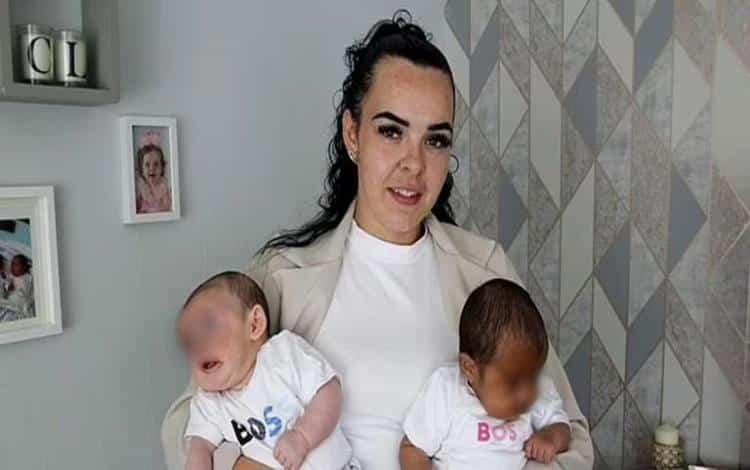 Nacen gemelos con diferente tonos de piel en Inglaterra Nacen gemelos con diferente tonos de piel en Inglaterra